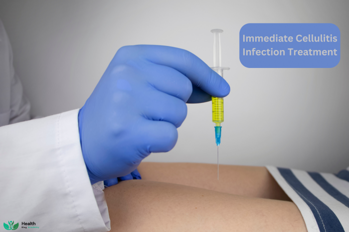 Unlocking the Secrets of Cellulitis Infection Treatment